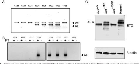 Figure 3 From Stem Cell Expression Of The Aml1 Eto Fusion Protein Induces A Myeloproliferative