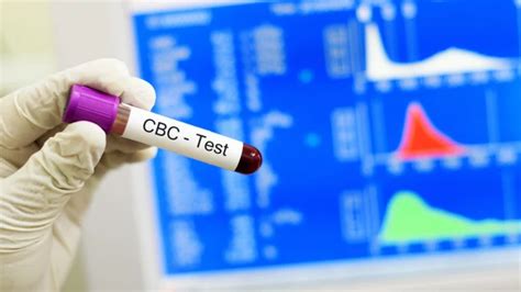 Clinical Laboratory Testing Parameters For Appropriate Interpretation