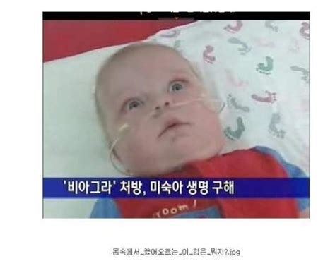 비아그라 처방 미숙아 생명구해 네이버 블로그
