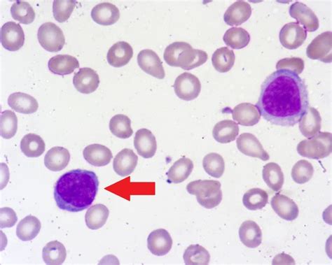 Mononuclear Cell Morphology Flashcards Quizlet