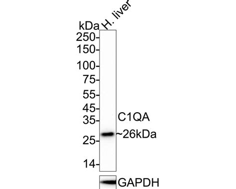 C1qa Recombinant Rabbit Monoclonal Antibody Je66 59 Ha721439 Huabio