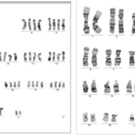 SNP Array Arr X Y X Download Scientific Diagram