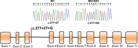 Schematic Diagram Showing The Location Of The C277 4 A T Mutation