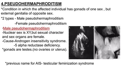 Intersex Forensic Medicine Pptx