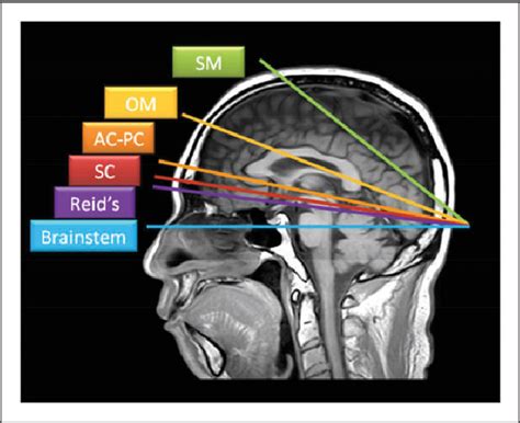 Figure 1 From A Guide To Identification And Selection Of Axial Planes