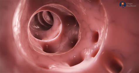 Divericulitis Causes Symptoms Diagnosis And Treatment Options