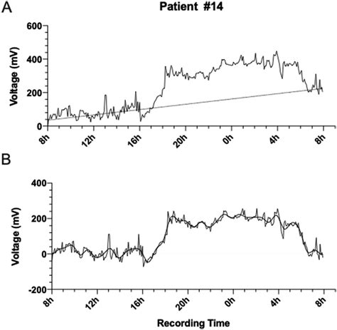 Signal Processing Steps With Matlab R2017b Mathworks Natick Ma
