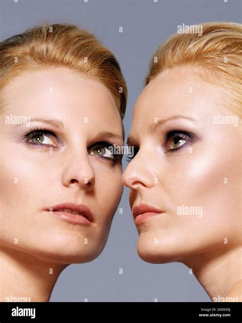 Identical Twin Sisters Genetically Identical Monozygotic Twins Arise When A Single Fertilised