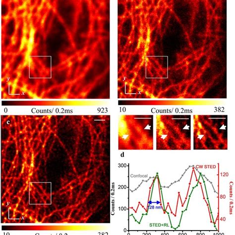 Comparison Of Diffraction Limited Confocal Microscopy And Sted