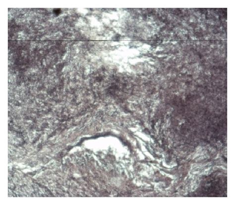 The Photomicrograph Of Concretion A The Photomicrograph Of A Cross Download Scientific