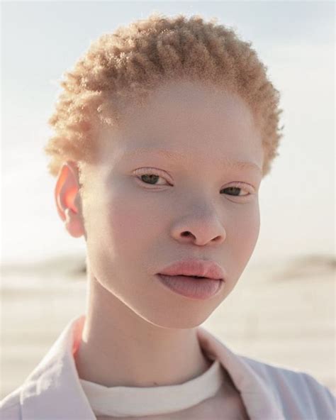 Nontobeko Mbuyazi On Instagram Photo Theodoreafrika” Albino Black
