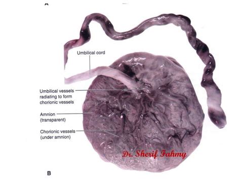 Umbilical Cord General Embryology PPS Pregnancy Reproductive Health