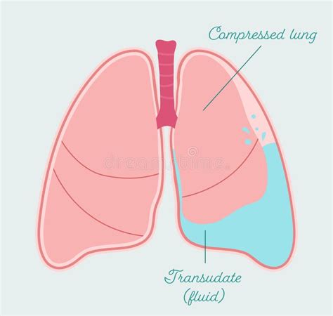Esquema Anatómico Del Cuerpo Humano En Diseño Plano Ilustración del ...