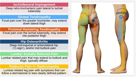 Ischiofemoral Impingement Clinical Perspectives For Enhancing