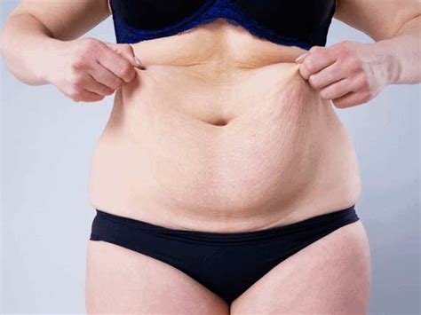 Gastric Bypass Healing Hands Health Care Centre