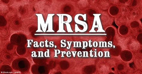 MRSA Infection Symptoms Prevention FREE Report
