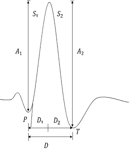 figure 2 from a review of eeg and meg epileptic spike detection