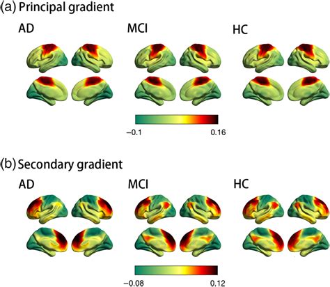 Connectome Gradient Mapping In The Alzheimers Disease Ad Mild
