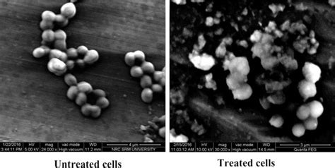 Scanning Electron Microscope Image Of M Luteus After Treatment With Download Scientific