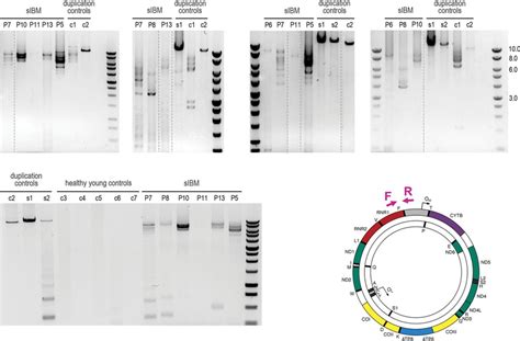 Assessment Of Duplications Of Mitochondrial Genome Duplication Pcr Download Scientific Diagram