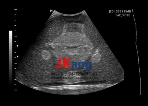 cirs 404a女性超声训练骨盆 sun nuclear 404a女性超声骨盆模体 深圳市净康科技有限公司官方网站