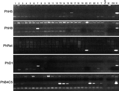 Characterization Of Nonfunctional V1R Like Pheromone Receptor Sequences In Human