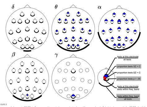 Figure 1 From Steady State Visual Evoked Potentials In Schizophrenia A
