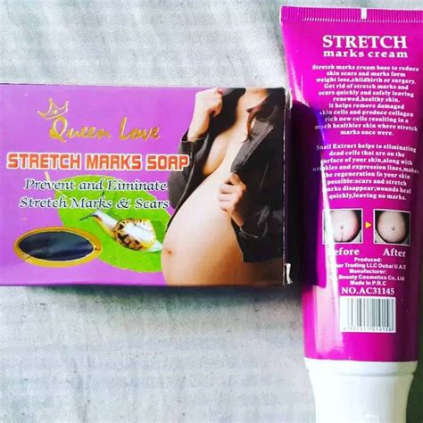 As Pomada Remove Estrias E Varizes Ela Remove Estrias E Varizes Ajuda