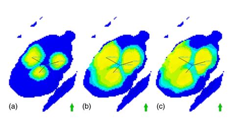 4d Seismic Used Effectively In Subsurface Co2 Plume Monitoring