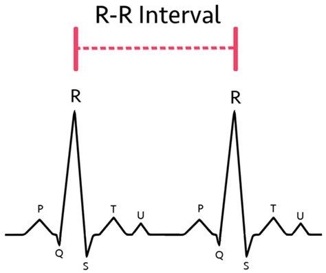 A Study Of R R Interval Transition Matrix Features For Machine Learning Algorithms In Afib Detection A Study Of R R Interval Transition Matrix Features For Machine Learning Algorithms In Afib Detection
