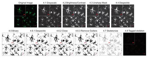 Quantifying Microglia Morphology From Photomicrographs Of Immunohistochemistry Prepared Tissue
