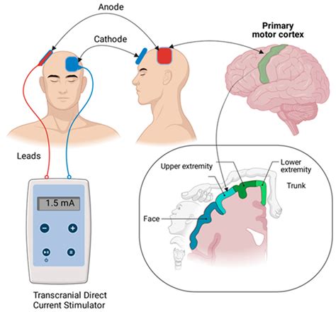Effect Of Transcranial Direct Current Stimulation Augmented With Motor Imagery And Upper Limb