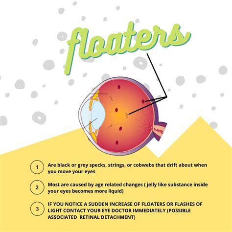 Can You See Floaters Eye Facts And Health Tips