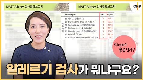 피부에 나타나는 다양한 알레르기 검사부터 치료방법까지 알려드립니다 Youtube