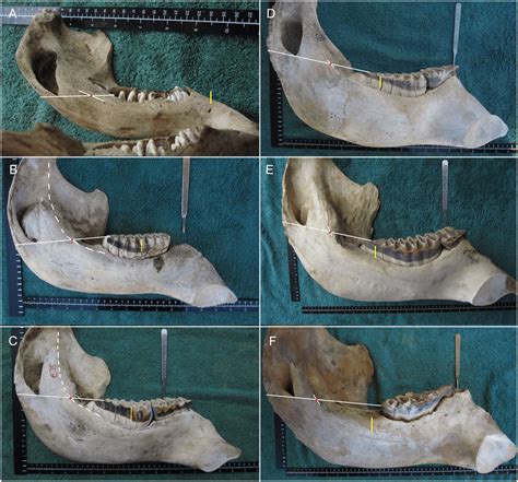 Placement Of The Age Reference Point ARP Red Dot And Age Reference Download Scientific
