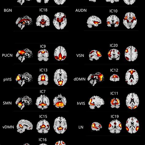 Spatial Maps Of 13 Identified Independent Components Ics The Ics