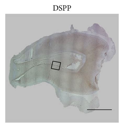 Immunohistochemical Ihc Staining Of Dental Pulp Tissue Ihc Staining Download Scientific
