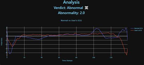 GitHub HOTSONHONET EasyBeat A Webapp That Takes Patients ECG Readings From Their Wearable