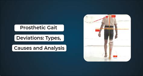 Prosthetic Gait Deviations Types Causes And Analysis Auptimo