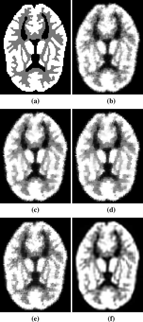 Top Left A Original Spect Phantom 128 128 Synthetic Phantoms With A