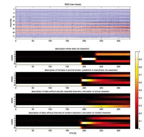 panel 1 shows the segment of the intracranial eeg recording of a class