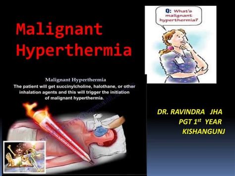 Malignant Hyperthermia Anaesthesia Point Of View Ppt