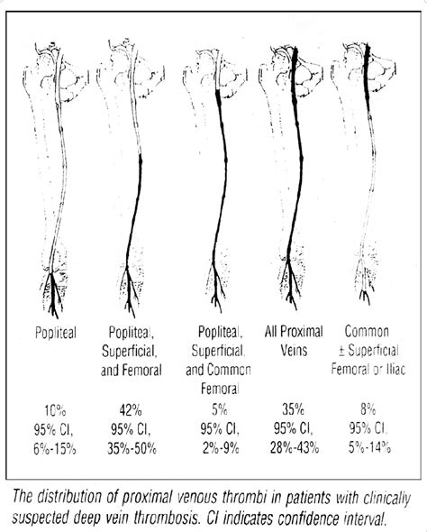 Distribution Of Deep Vein Thrombosis Dvt In 562 Patients With A