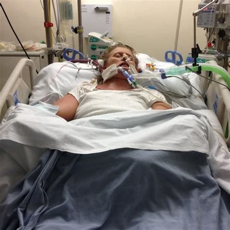 Sepsis And Amputation A Complete Guide By Finding Your Feet — Limb Loss And Limb Difference