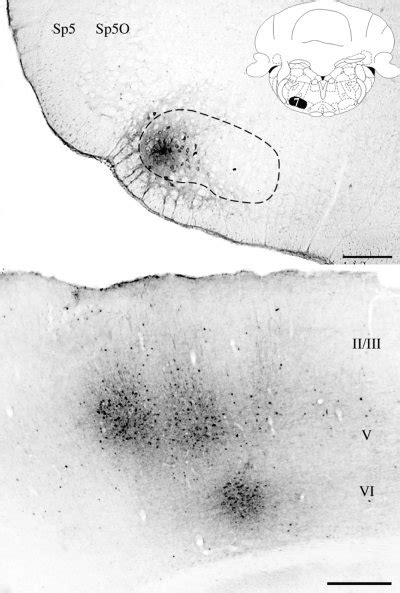Photomicrographs Of Retrograde And Anterograde Tracer Injection Sites