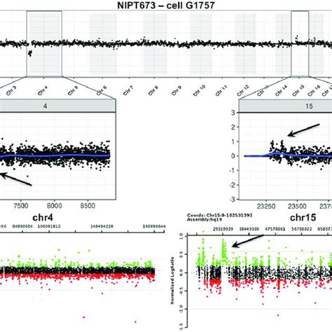 Detection Of A Complex Subchromosomal Gain On Chromosome 16p Panels A