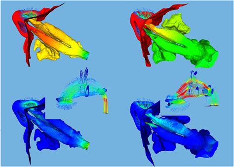 Reducing Variability In Nasal Surgery Outcomes Through Computational Fluid Dynamics And Advanced