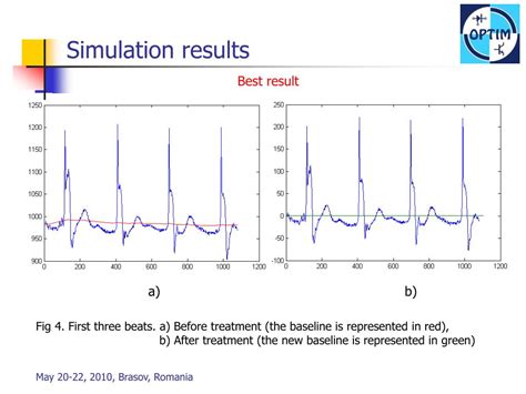 Ppt Electrocardiogram Baseline Wander Removal Using Stationary Wavelet Approximations
