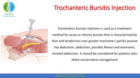 Iliopsoas Bursa Injection