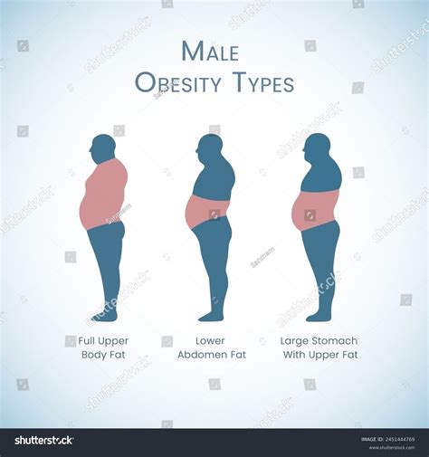 Male Obesity Types Creative Vector Illustration Stock Vector Royalty Free 2451444769